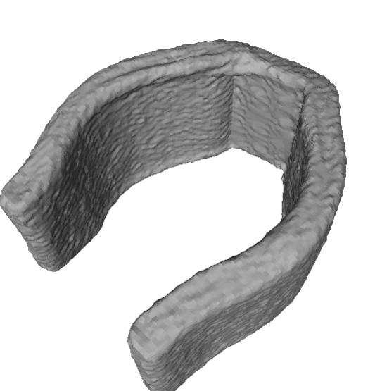 Using a “pulley splint” to support your finger – The Beta Angel Project